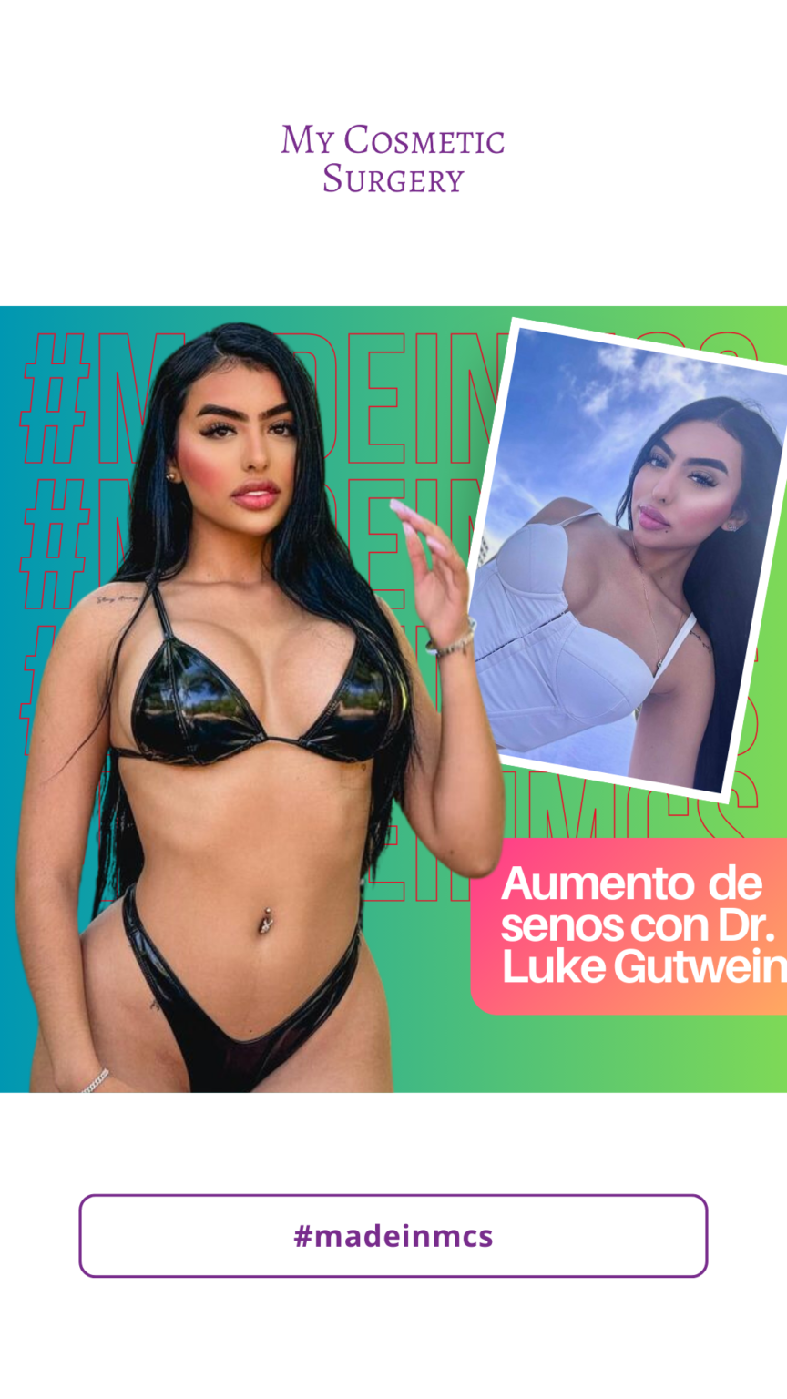 Before & After - My Cosmetic Surgery