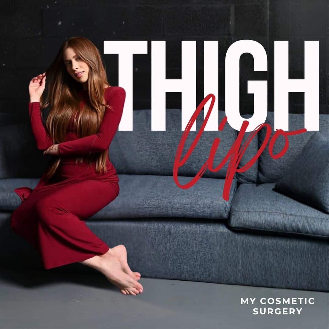 Thigh Liposuction | My Cosmetic Surgery Miami